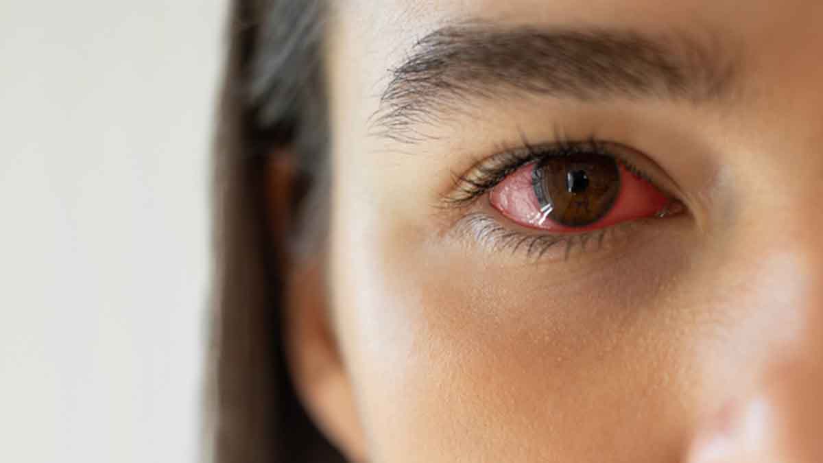 Inflamação nos vasos sanguíneos: entenda o que é vasculite | Blog dr ...