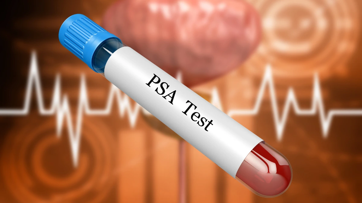 Entenda o que é o exame de PSA e quando ele é indicado | Blog dr.consulta
