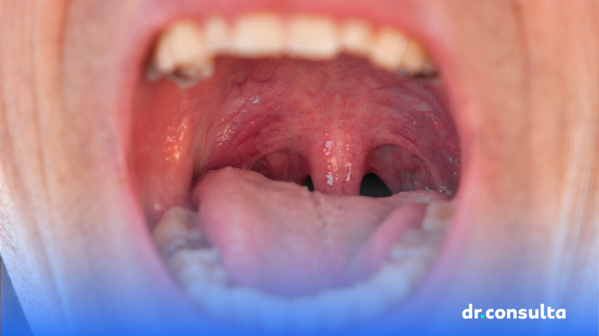 Saiba as causas da garganta seca e como aliviar esse sintoma | Blog dr ...