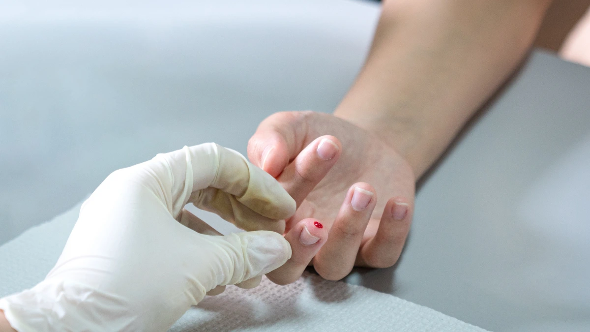 O que é o exame de hemoglobina glicada (HbA1c)? | Blog dr.consulta