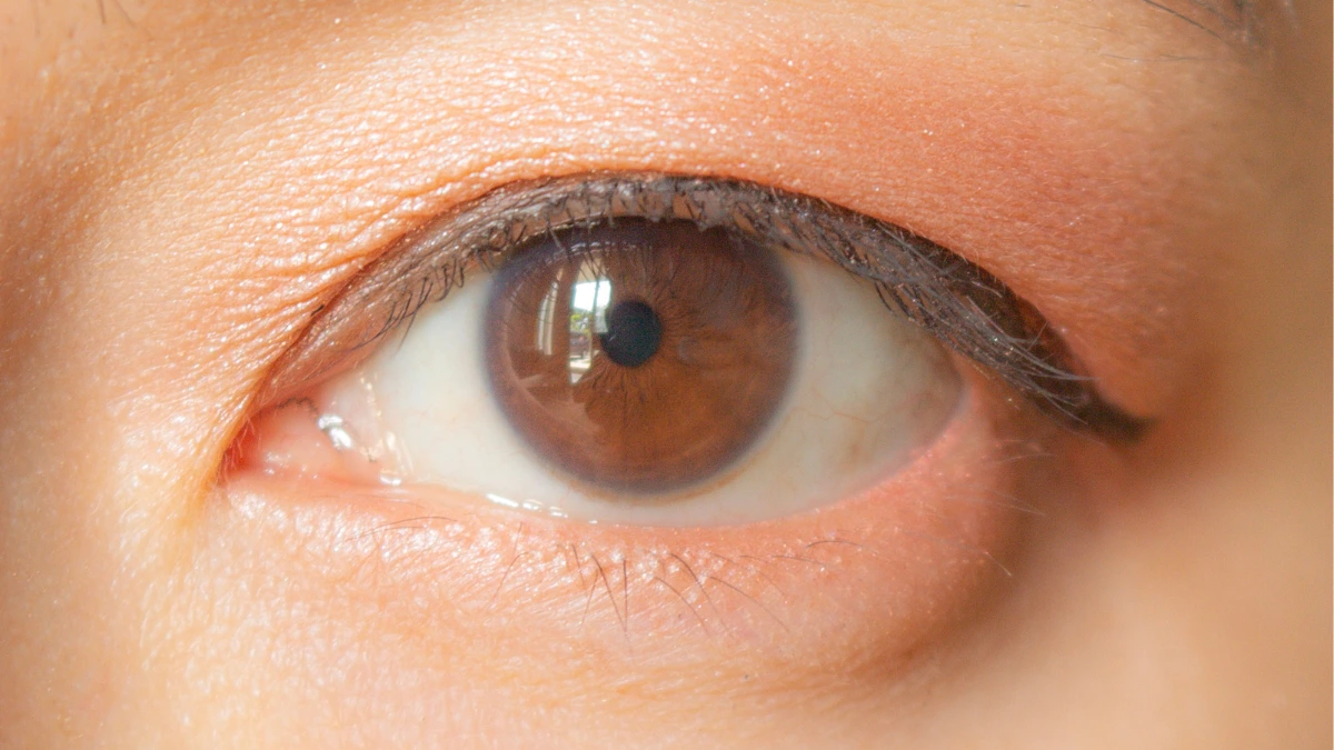 Entenda o leucoma, sintomas, tratamento e como prevenir | Blog dr.consulta